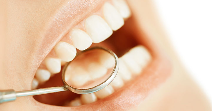 Value Dental, Longview TX